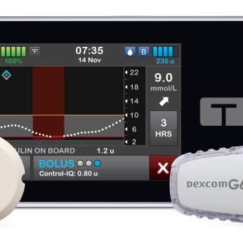 Control-IQ™ Technology | Making Diabetes Easier