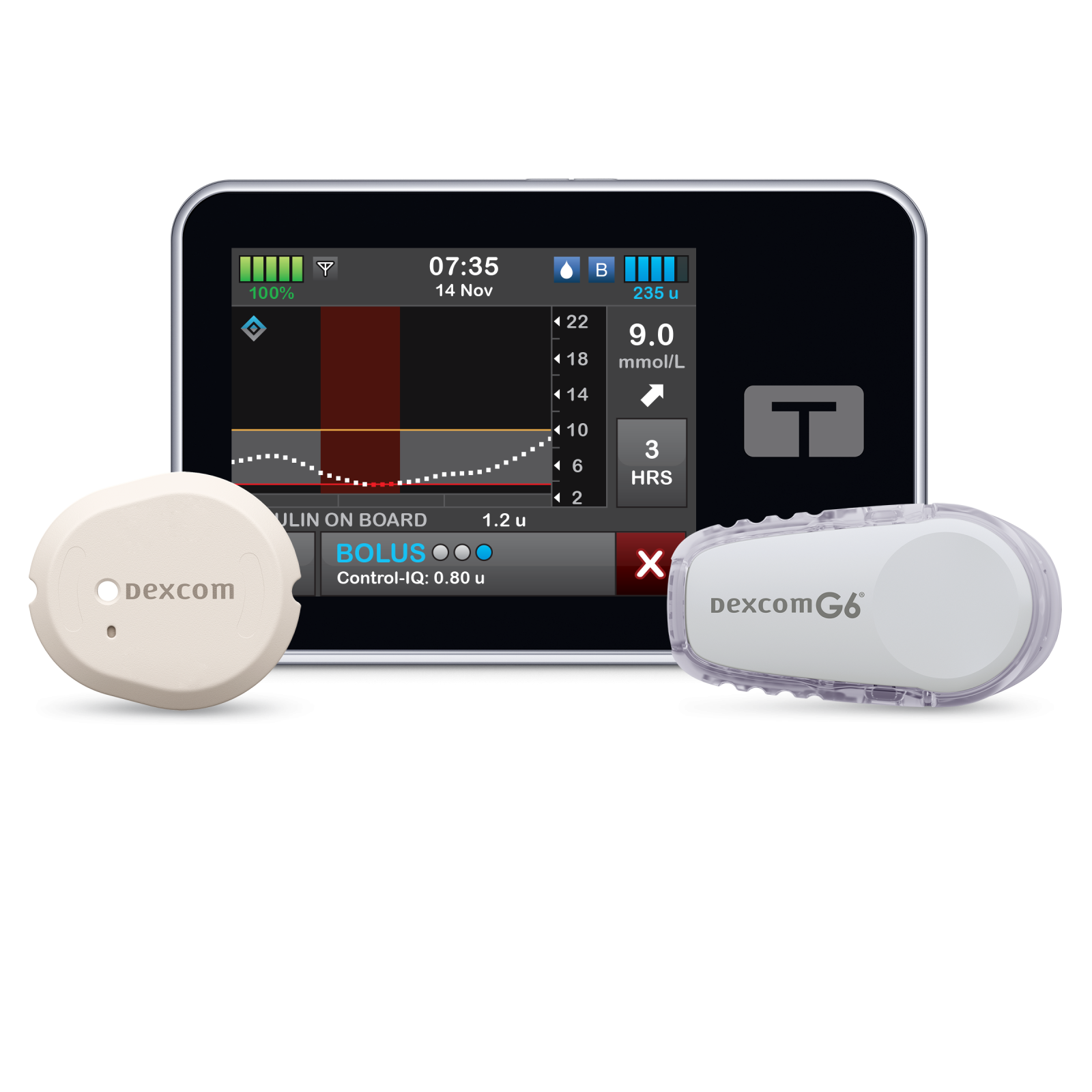 Control-IQ™ Technology | Making Diabetes Easier